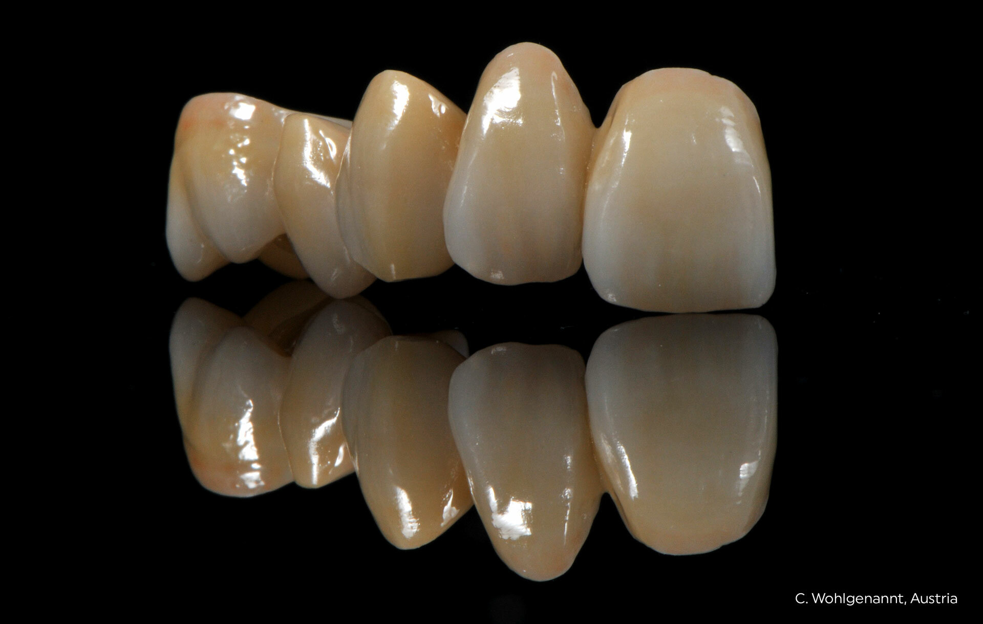 IPS e.max ZirCAD Prime | Zirconia Restorations | Ivoclar